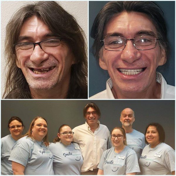Waco Smile Makeover – Smiles For Everyone Foundation